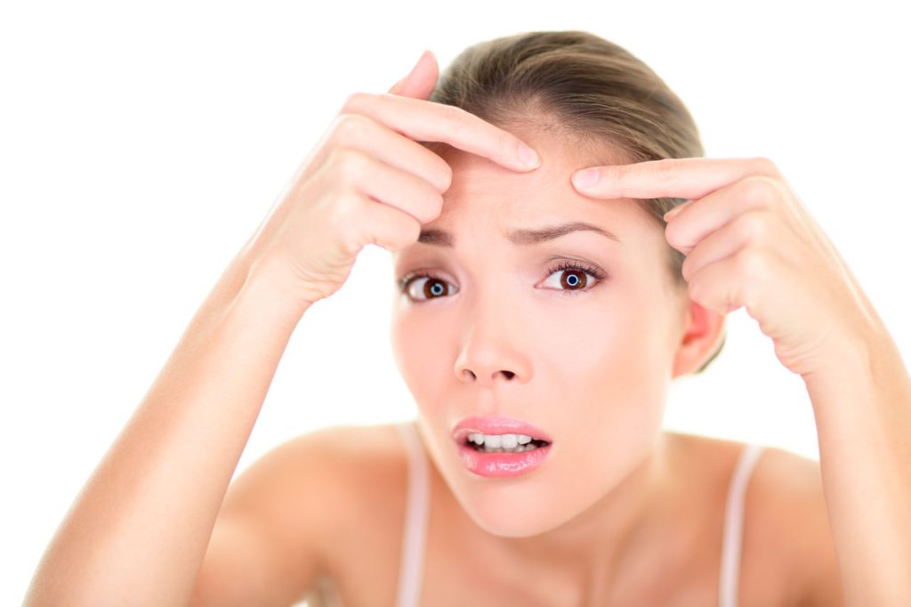 10 Remedios Naturales para Eliminar las Espinillas | Mis Remedios