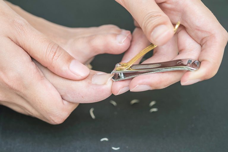 7 Remedios Caseros para las Uñas Encarnadas | Mis Remedios